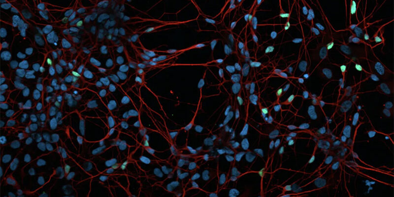 Finnish scientists take important step within stem cell-based disease ...